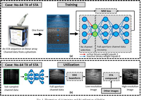 Figure 1 From Rxnet Learning For Receive Element Reduction In Synthetic Transmit Aperture