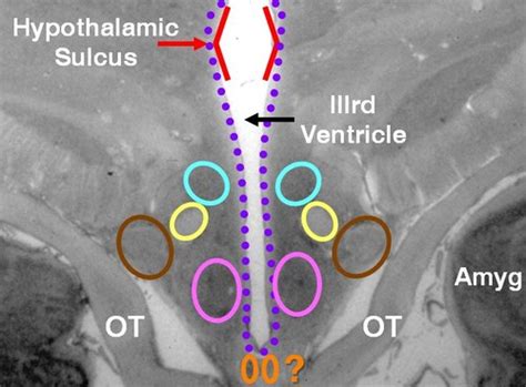 Hypothalamus Zones Flashcards Quizlet