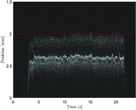 Instrument Integrated Oct Based Sensor A Scan Recordings Of Step 4
