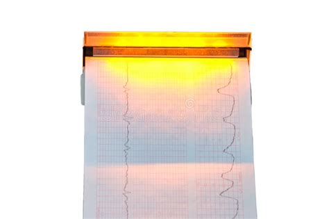 Ctg Device With Monitoring Of The State Of Health Of The Mother And