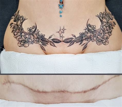 Tummy Tuck Tattoo Ideas