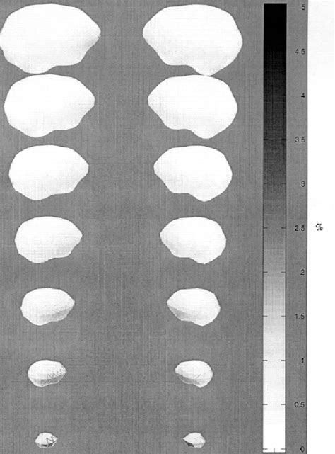 Figure 5 From A Sensor Weighted Overlapping Sphere Head Model And