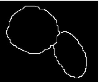 Image Processing Over Segmentation In The Marker Controlled Watershed In Matlab Stack Overflow
