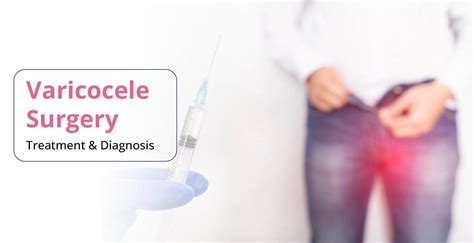 Varicocele Causes Symptoms Diagnosis And Treatment Birla Fertility And Ivf