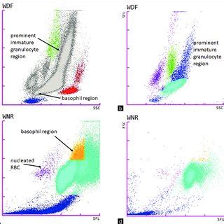 Chronic Myeloid Leukemia Biology Diagnosis And 52 OFF