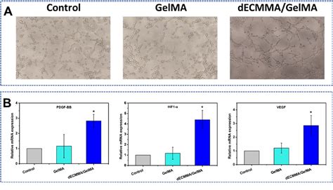 Figure 5 From Design And Fabrication Of Gelatin Based Hydrogel Loaded With Modified Amniotic