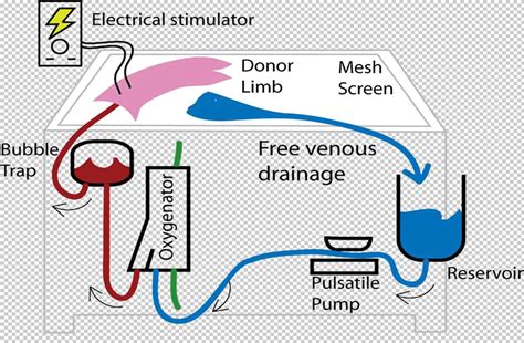 Ex Situ Limb Perfusion System Download Scientific Diagram
