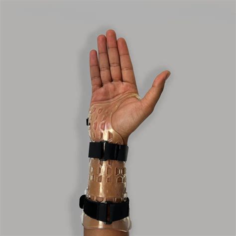 Cock Up Splint Model Namenumber Mscssizew At ₹ 2500piece In