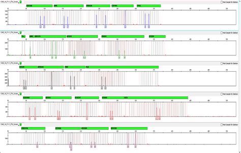 Electropherogram Of DNA Isolated From Blood Sample On FTA Card Of The Download Scientific