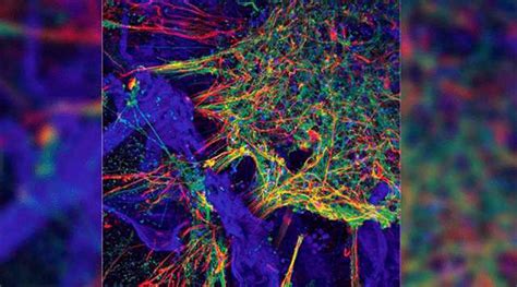 Neural Stem Cell And Their Role In Developing Regenerative Medicine