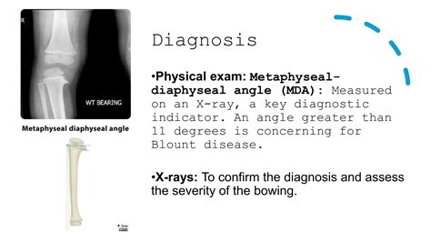 Angular Deformities Of The Lower Limppptx Death Injury Or Military