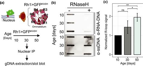 Aging Photoreceptor Neurons Show Increased Global Rloop Levels That
