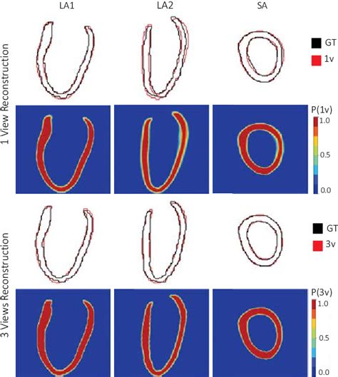 3d high resolution cardiac segmentation reconstruction from 2d views