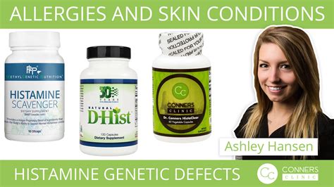 Allergies Skin Conditions And Histamine Genetic Defectsconners Clinic