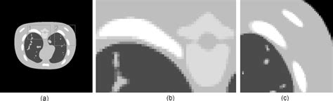 Figure 1 From A Non Smooth And Non Convex Regularization Method For Limited Angle Ct Image