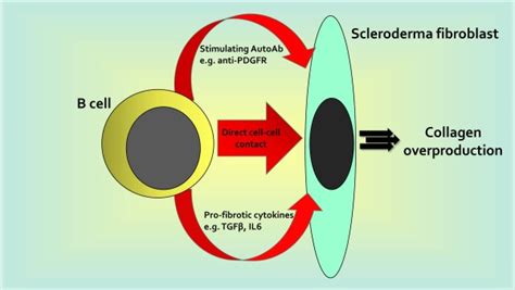 B Cells Tell Scleroderma Fibroblasts To Produce Collagen Pmc