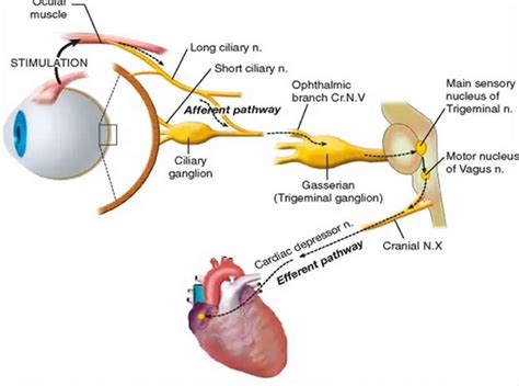 Oculocardiac Reflex Causes Pathway Symptoms And Treatment