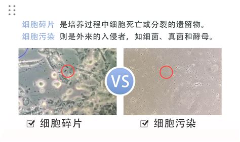细胞碎片可能的原因和恢复方法及其与细胞污染的区别 生物器材网