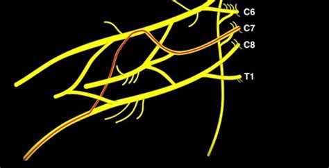 12 Brachial Plexus Topography Flashcards Quizlet