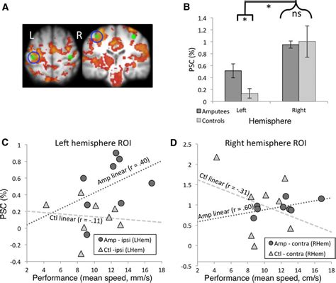 Roi Analysis Of Psc In Normative Sensorimotor Hand Area Showing