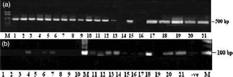 Rapd Fi Ngerprints For Acinetobacter A Summer And Citrobacter B Download Scientific