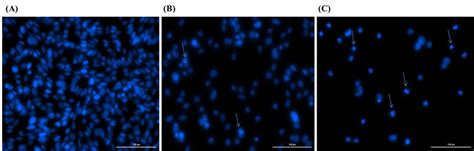 Representative Photograph Showing Dapi Staining Of Untreated Control