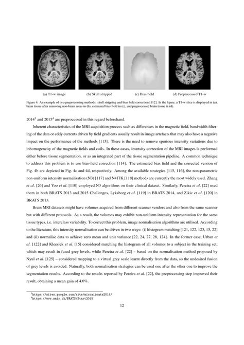 Deep Convolutional Neural Networks For Brain Image Analysis On Magnetic