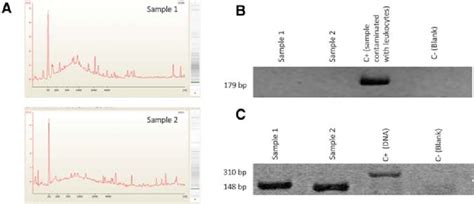 Quality Controls On Sperm Rna Samples A Agilent Bioanalyzer Profiles Download Scientific
