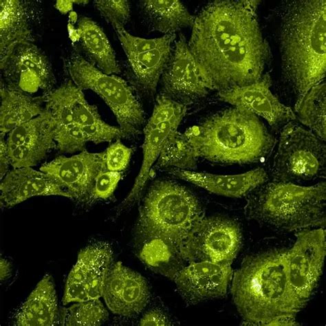 Opera Phenix Plusハイコンテントスクリーニングシステム Revvity