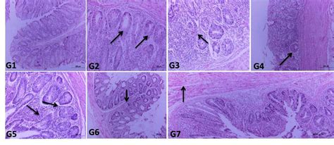Cross Section Of Caecum At 7 Th Days Post Infection Of Different Download Scientific Diagram