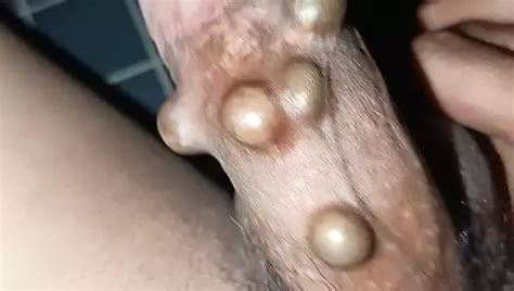 Watch Me Put A Speculum Inside My Penis Head Gay Amateur Porn Xhamster