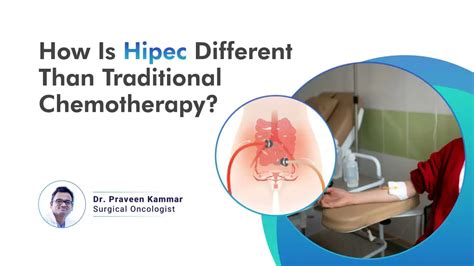 How Is Hipec Different Than Traditional Chemotherapy