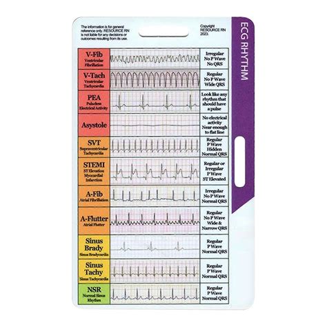 Electrocardiogramekg Rhythms Pocket Card Double Sided Ekg Rhythms Interpretation Reference Card