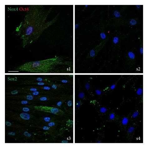 Effect Of Donor Heterogeneity On Stem Cells Markers A Representative Download Scientific