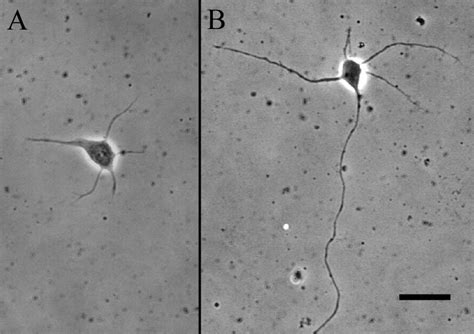 3 Chick Forebrain Neuron In Culture A 1 Day In Vitro Neurite Download Scientific Diagram