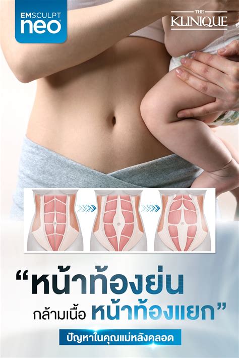 Pico Clear Enlighten Fx “ผิวไม่เสียหาย สลายทุกปัญหาเม็ดสีผิว” Theklinique