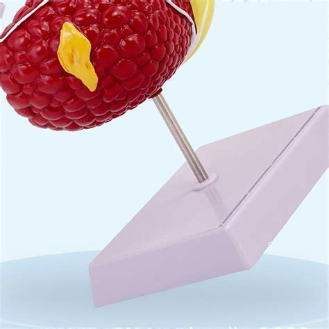 Liver Model For Common Pathologies Liver Model Human Anatomy Doctor