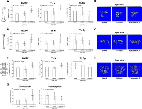 Hdac6 Inactivates Runx2 Promoter To Block Osteogenesis Of Bone Marrow