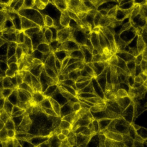 E Cadherin And β Catenin Interactions Navinci