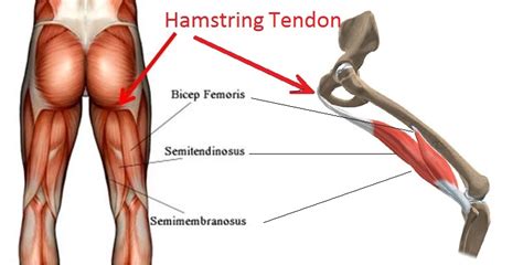 Hamstring Tendinopathy In Runners Physio 4 Richmond