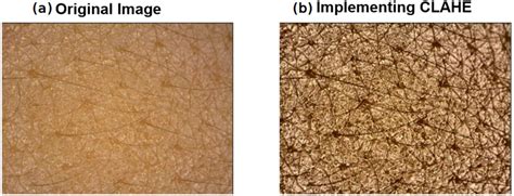 Comparison Between A The Original And B Enhanced Image Using Clahe Download Scientific Diagram