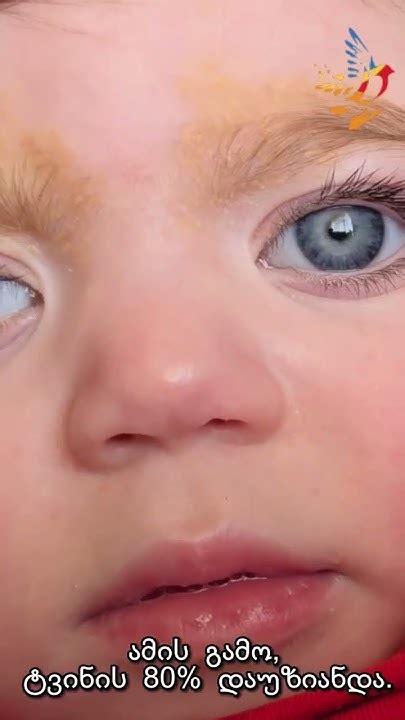 💔„თქვენი შვილი გარდაიცვალა“ — საშინელი ზარი საავადმყოფოდან და სასწაულებრივად გაცოცხლებული Youtube