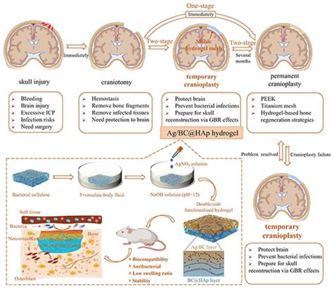 Biomimetic Design Of Double Sided Functionalized Silver Nanoparticle