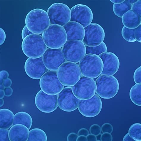 How Food Spoils Unl Food Nebraska