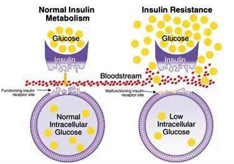 About Health Insulin Resistance