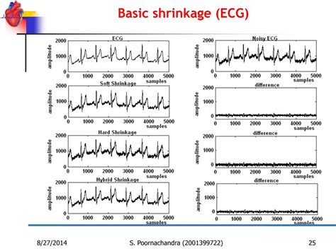 Ppt Wavelet Based Subband Shrinkage Models And Their Applications In