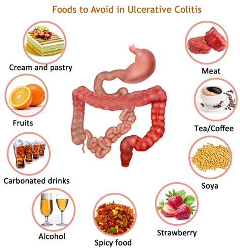 Diet And Herbal Remedies For Ulcerative Colitis Dr Vikram Chauhans Blog