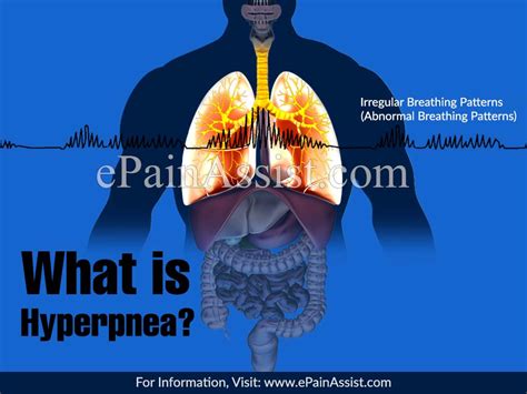 Hyperpnea Causes And Treatment Options