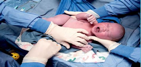 Neonatal Resuscitation Program® Nrp Gulf Cpr