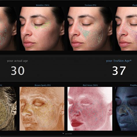 Visia Skin Analysis Valley View Dermatology And Aesthetics